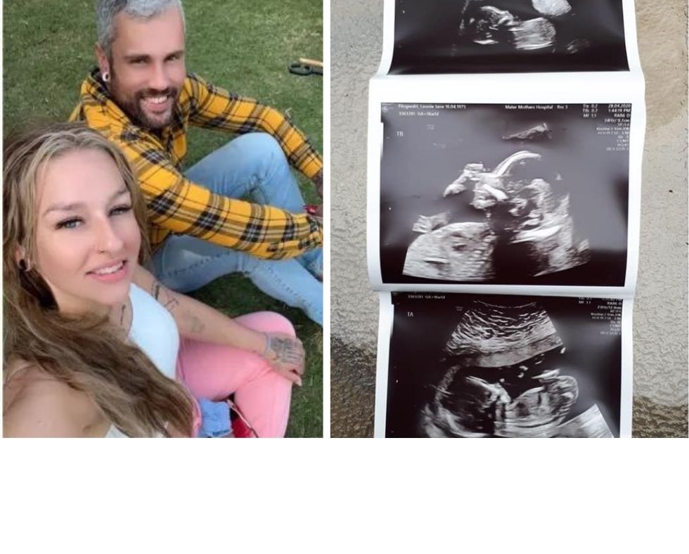 “Teen Mom” star Ryan Edwards Stuns Fans with Family Growth Update!